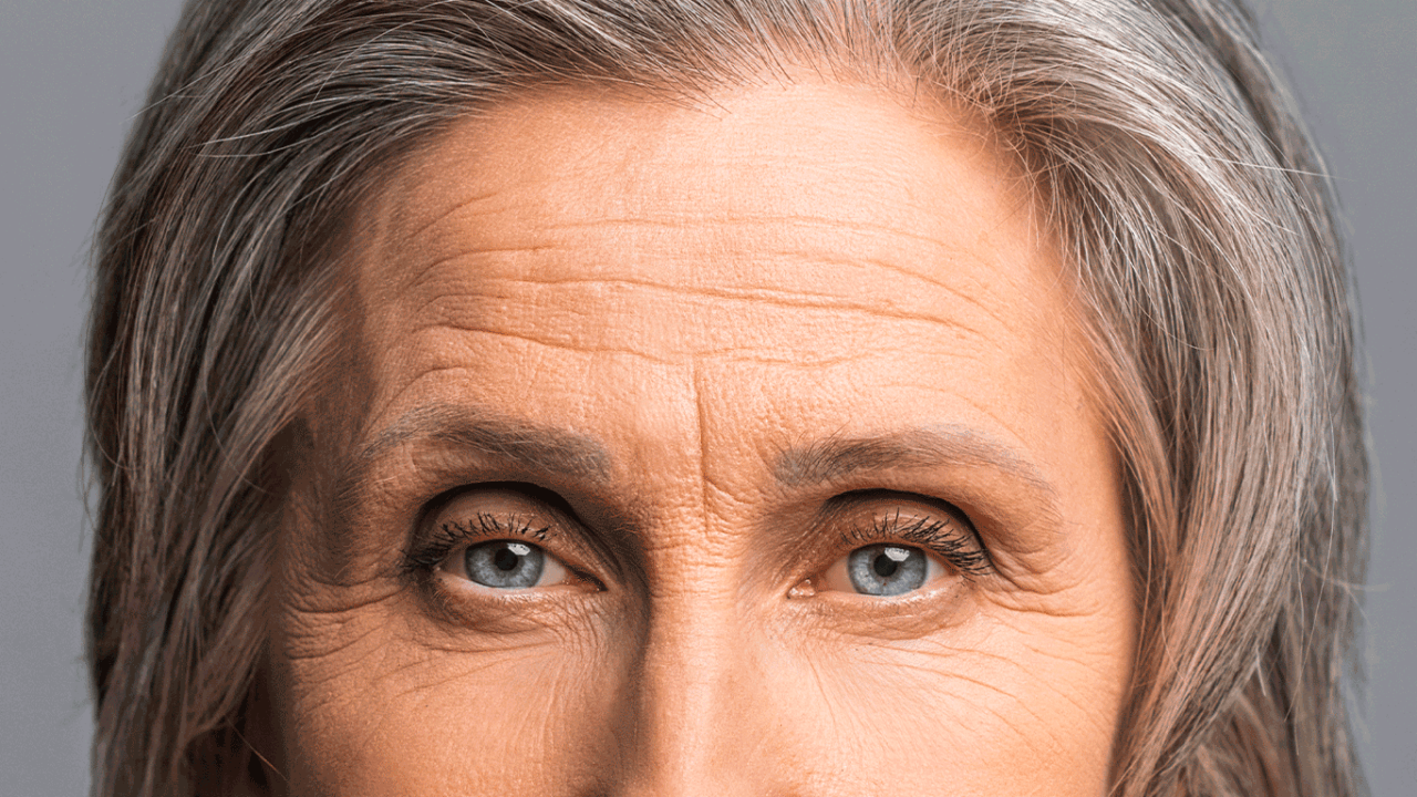 Estompez vos Rides | Clinique MédicoDerma Dre Lydia Monette