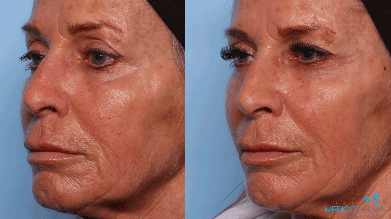 Clinique MedicoDerma- Dre Lydia Monette | Médecine Esthétique