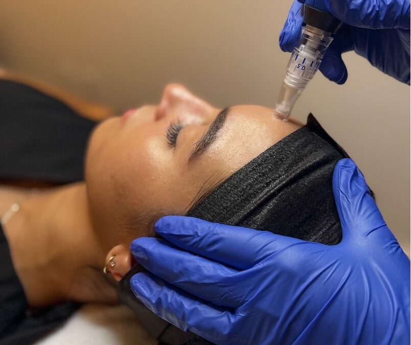 Traitements Médico Esthétique | Clinique MedicoDerma- Dre Lydia Monette